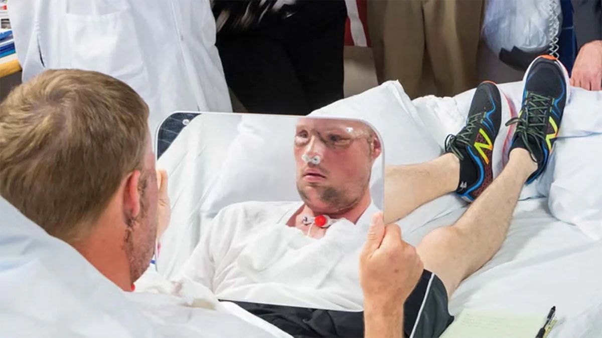 How A Face Transplant Gave A Newcastle Man A New Smile And Life ...